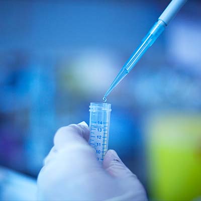 Seeking Postdoctoral Fellow in Dr. Yan Jie’s & Dr. Alexander Ludwig’s ...