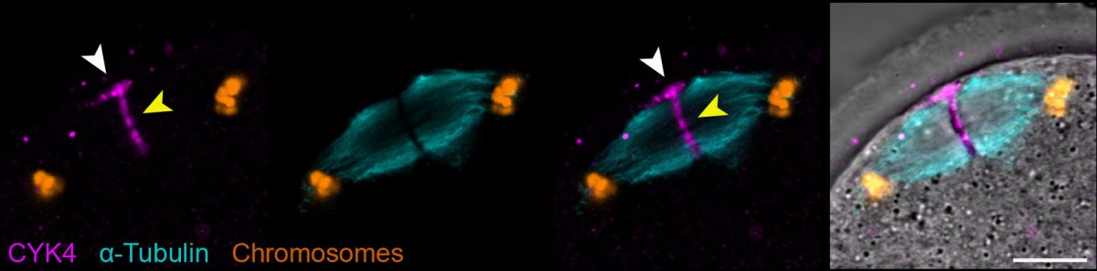Rong Li Lab - Mechanobiology Institute, National University of Singapore