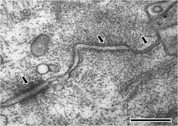 What are cell-cell adhesions? - Mechanobiology Institute, National ...