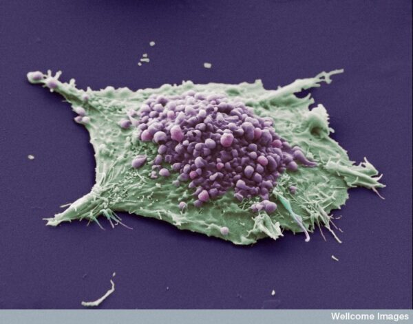 What are Blebs? - Mechanobiology Institute, National University of ...